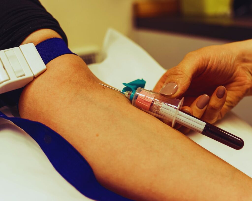 What Is a Blood Split Motion—And Can It Help You Beat a DUI ...